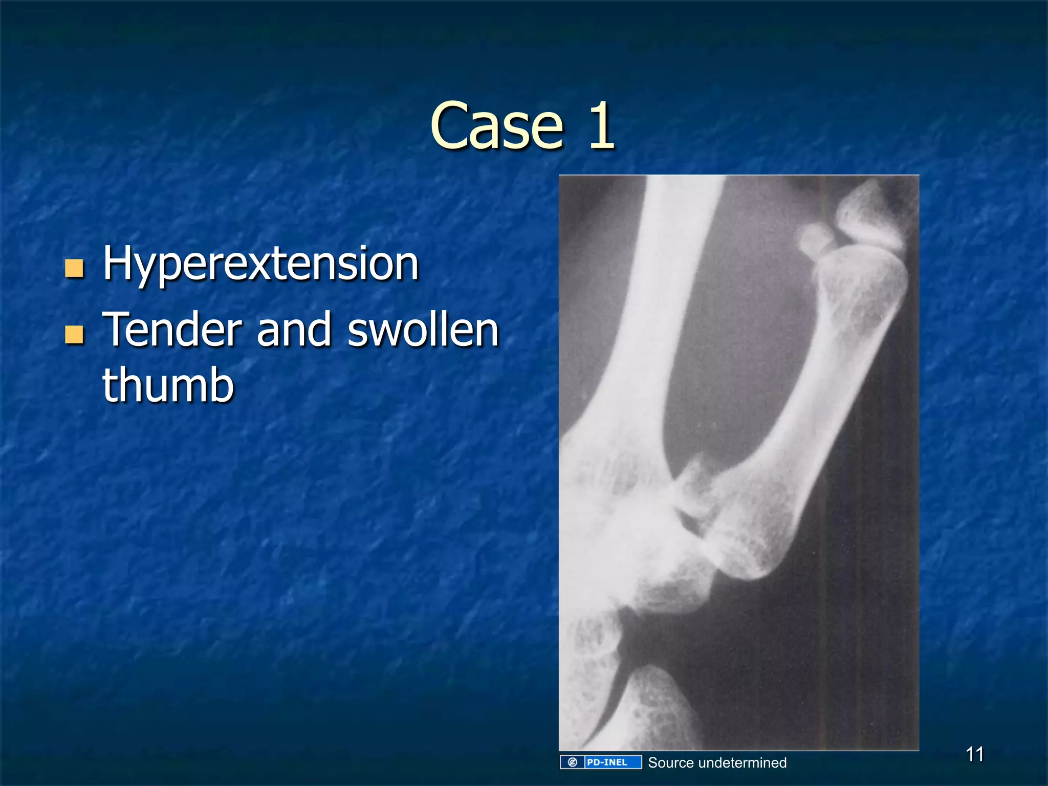GEMC: Radiology: X-rays of the Hand and Wrist: Resident Training | PDF