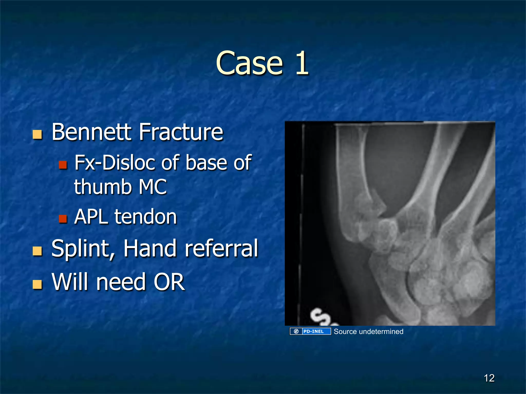 GEMC: Radiology: X-rays of the Hand and Wrist: Resident Training | PDF