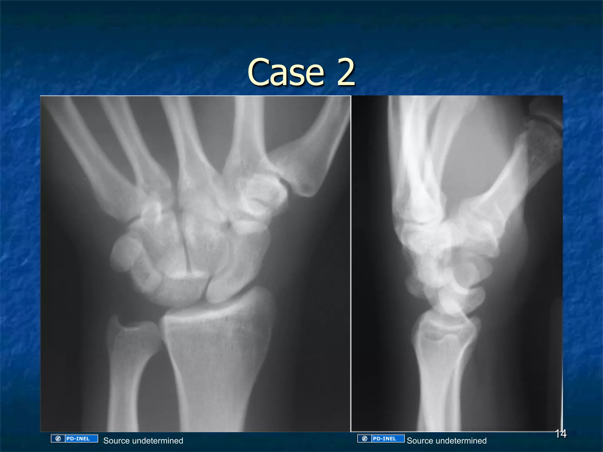 GEMC: Radiology: X-rays of the Hand and Wrist: Resident Training | PDF