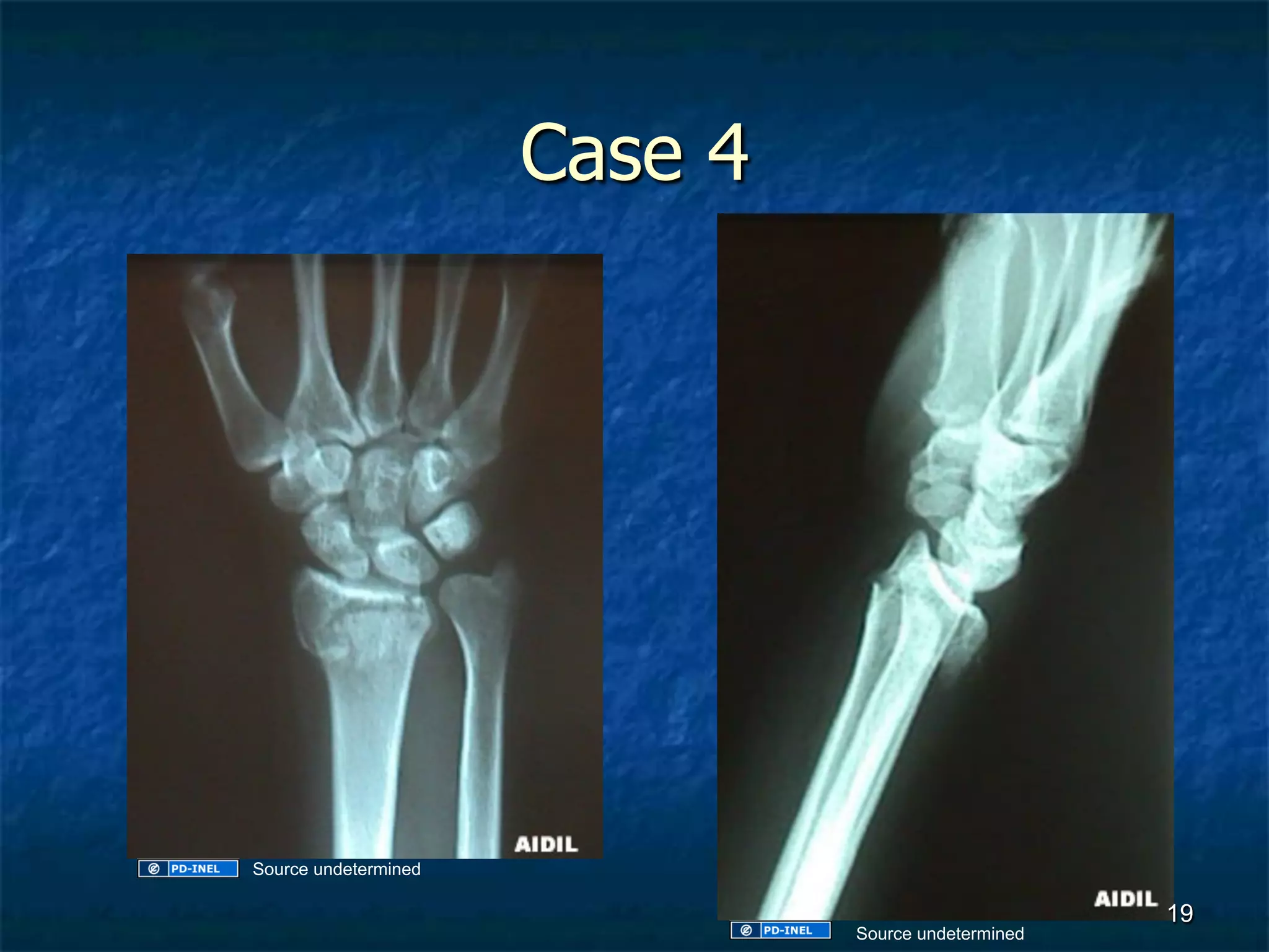 GEMC: Radiology: X-rays of the Hand and Wrist: Resident Training | PDF
