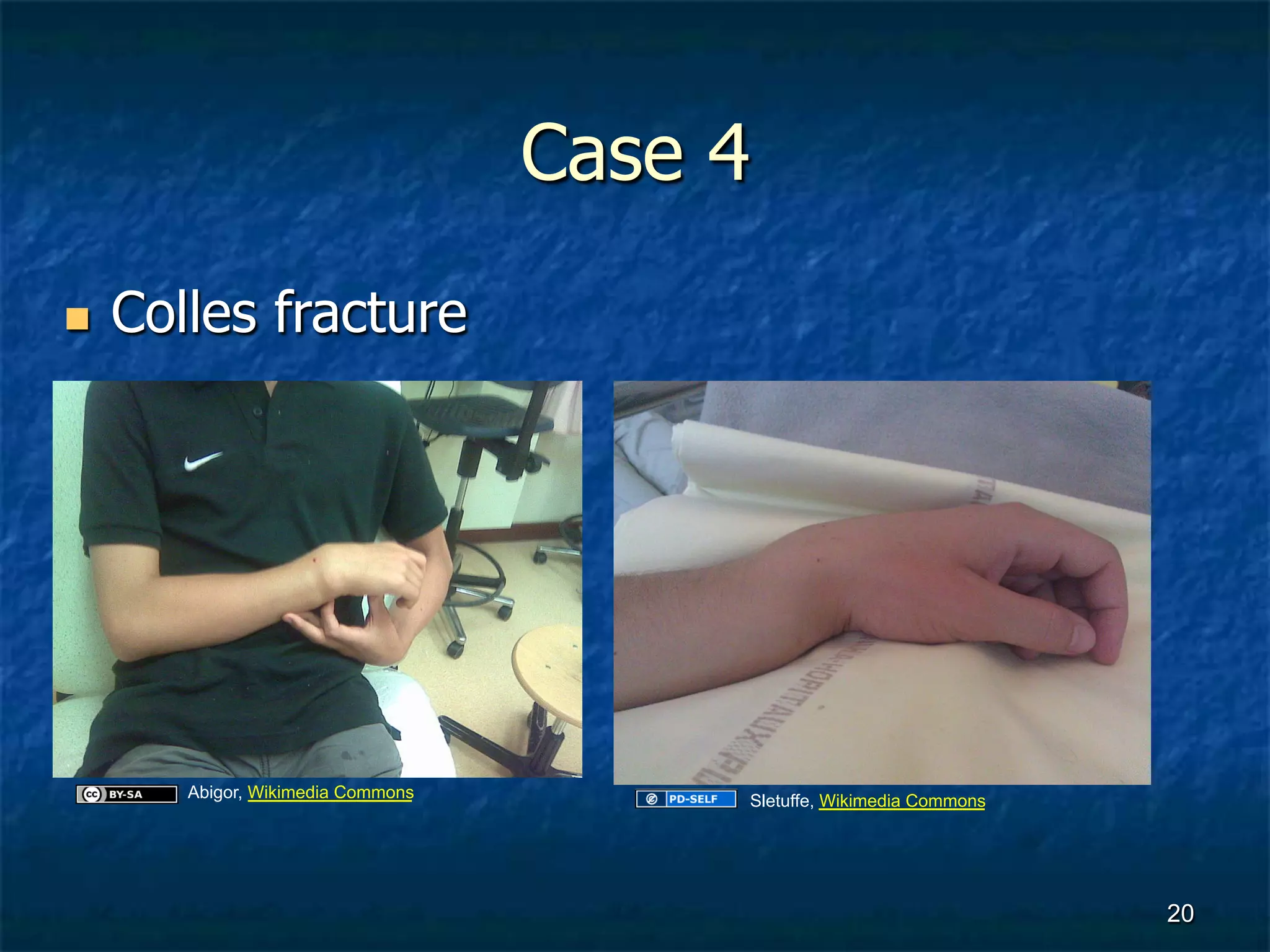 GEMC: Radiology: X-rays of the Hand and Wrist: Resident Training | PDF