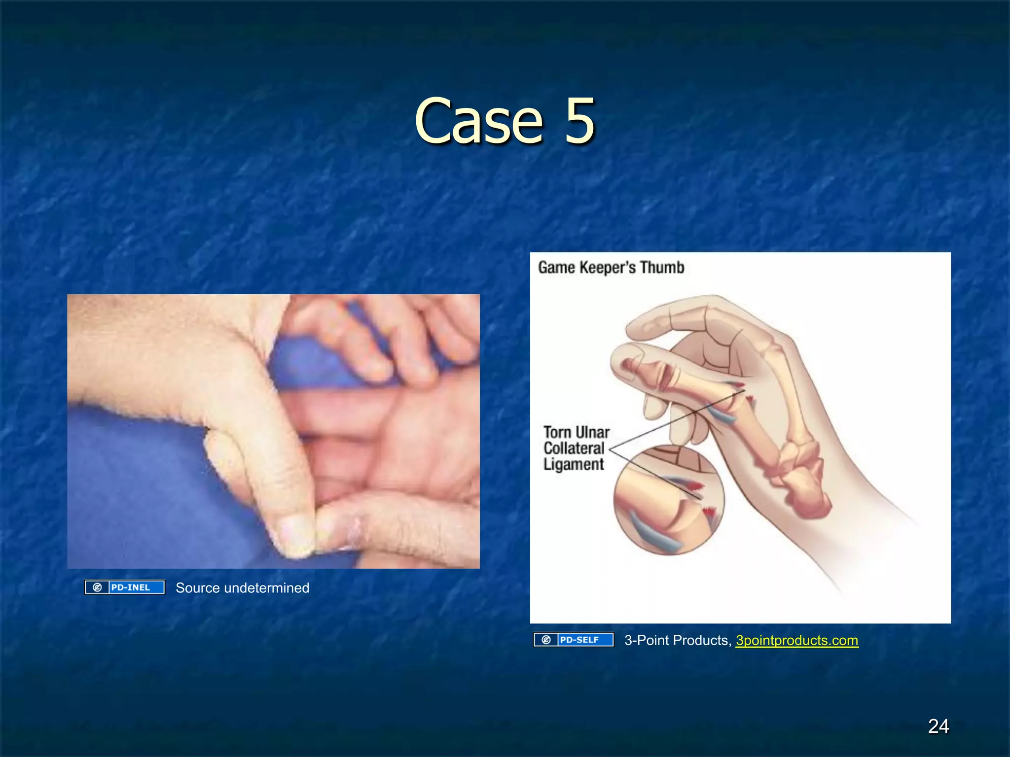 GEMC: Radiology: X-rays of the Hand and Wrist: Resident Training | PDF