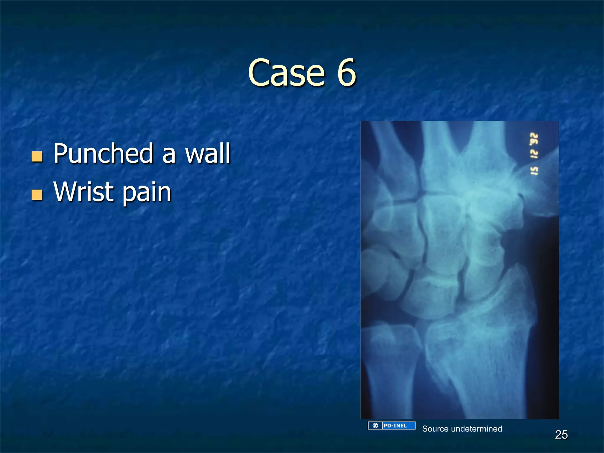 GEMC: Radiology: X-rays of the Hand and Wrist: Resident Training | PDF
