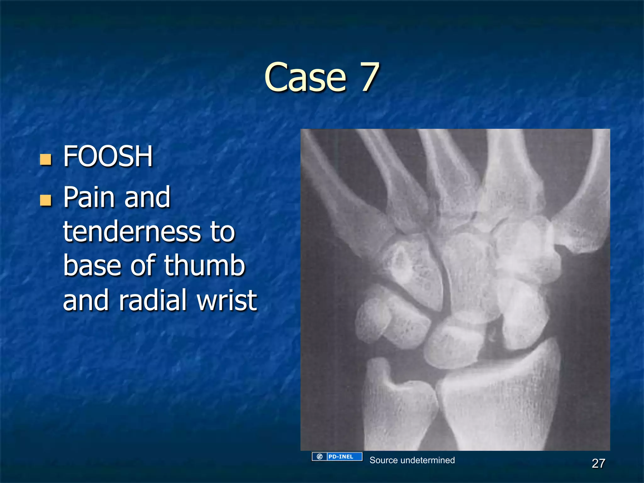 GEMC: Radiology: X-rays of the Hand and Wrist: Resident Training | PDF