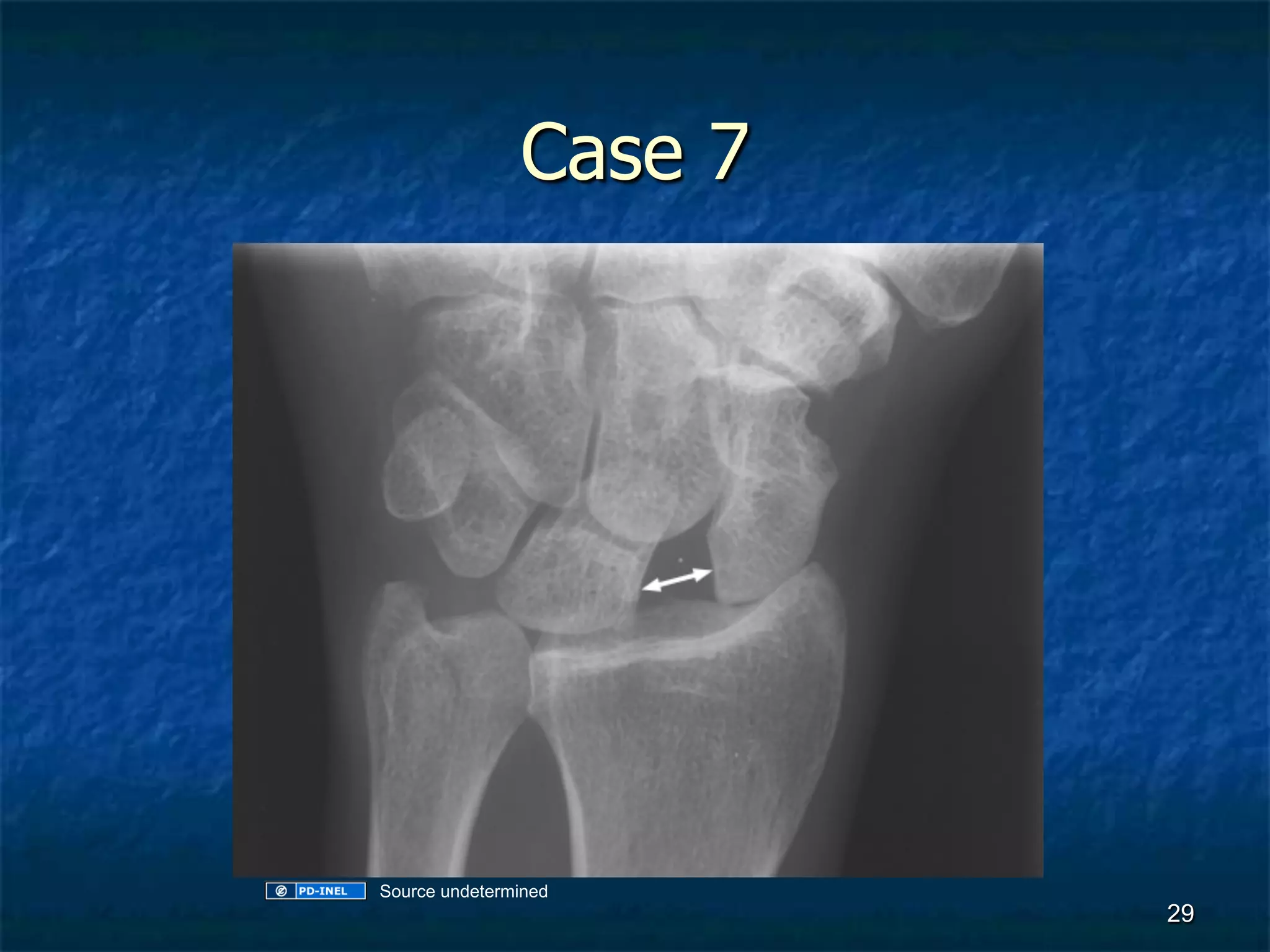 GEMC: Radiology: X-rays of the Hand and Wrist: Resident Training | PDF