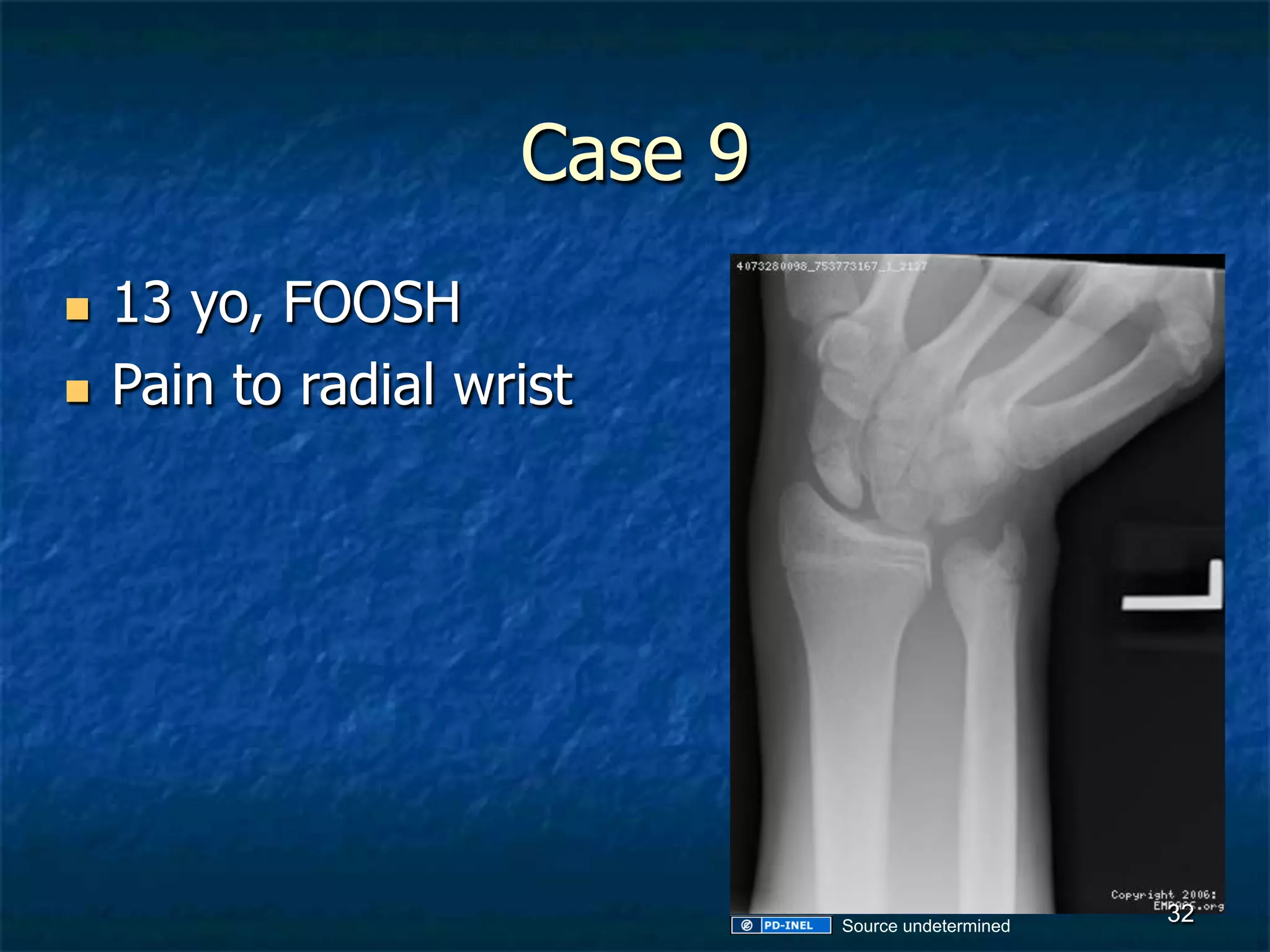 GEMC: Radiology: X-rays of the Hand and Wrist: Resident Training | PDF