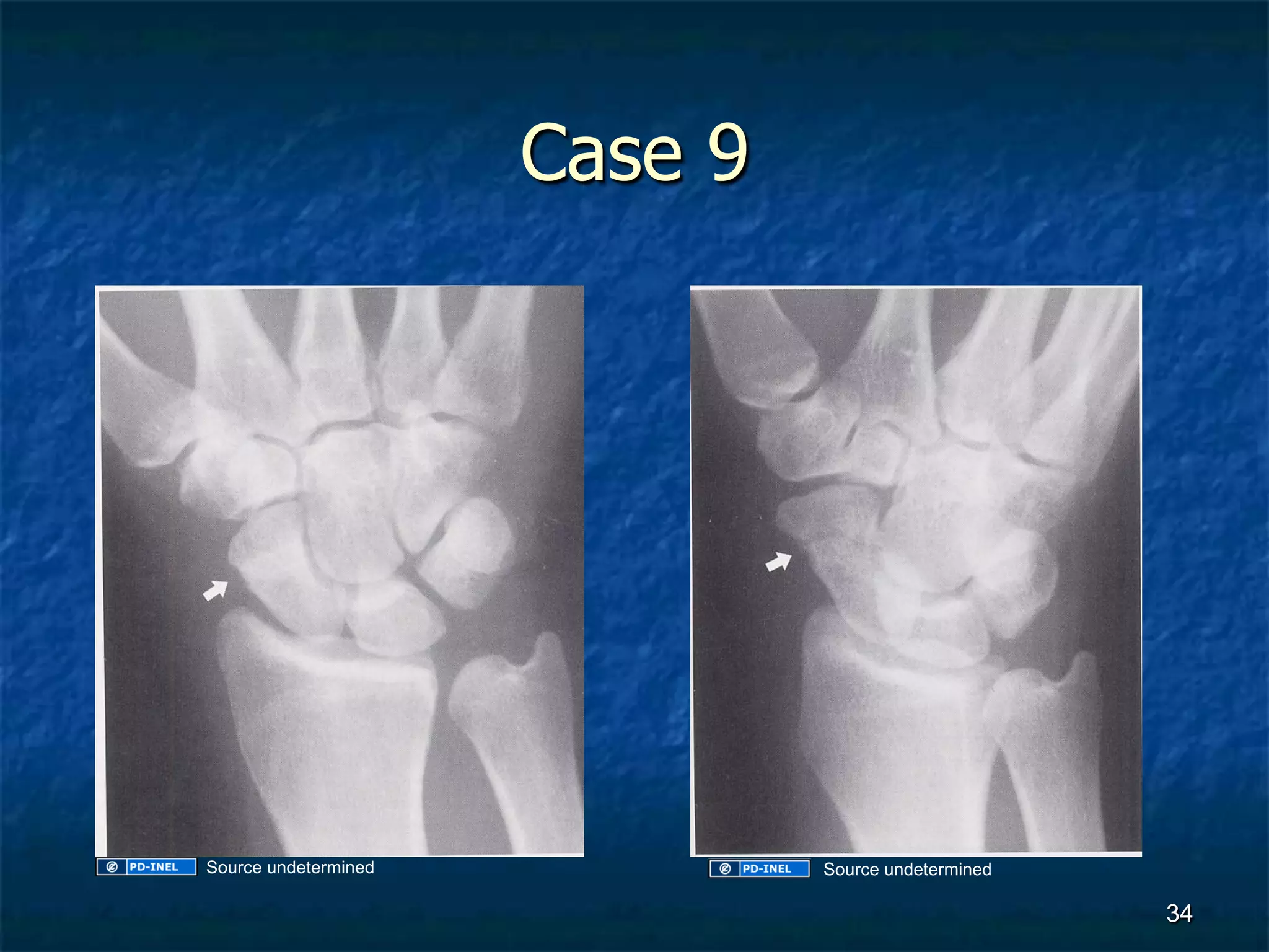 GEMC: Radiology: X-rays of the Hand and Wrist: Resident Training | PDF