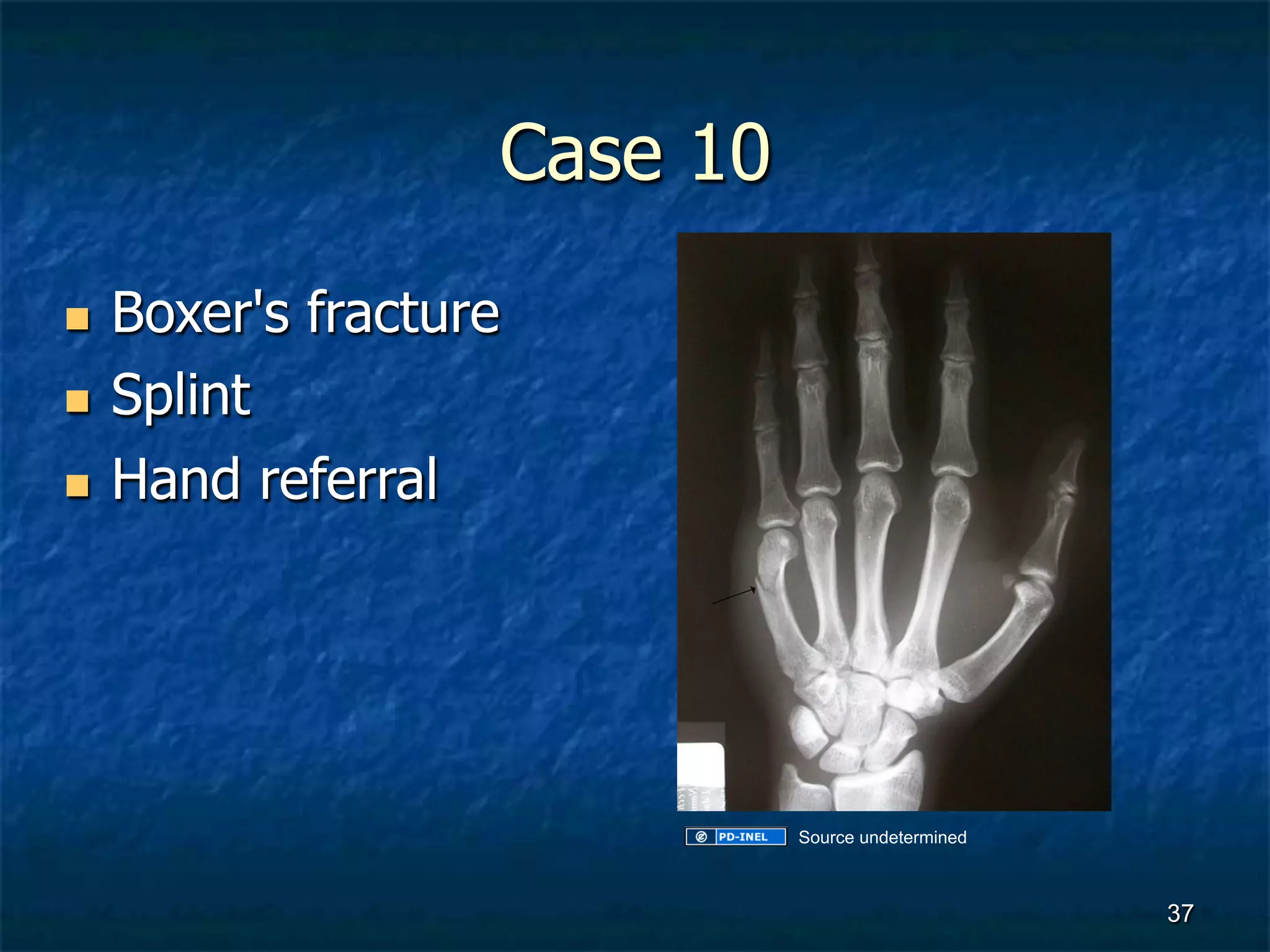 GEMC: Radiology: X-rays of the Hand and Wrist: Resident Training | PDF