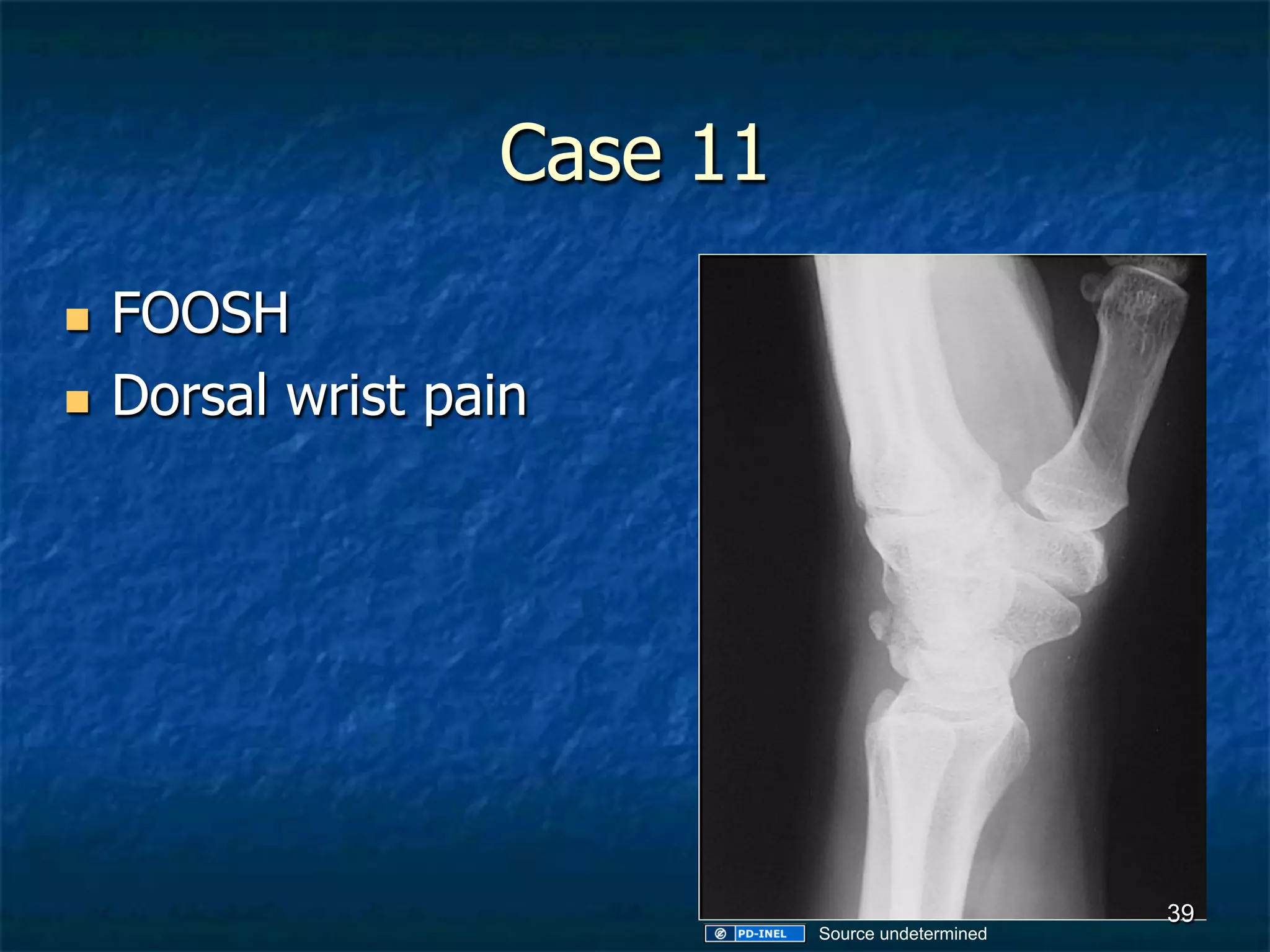 GEMC: Radiology: X-rays of the Hand and Wrist: Resident Training | PDF