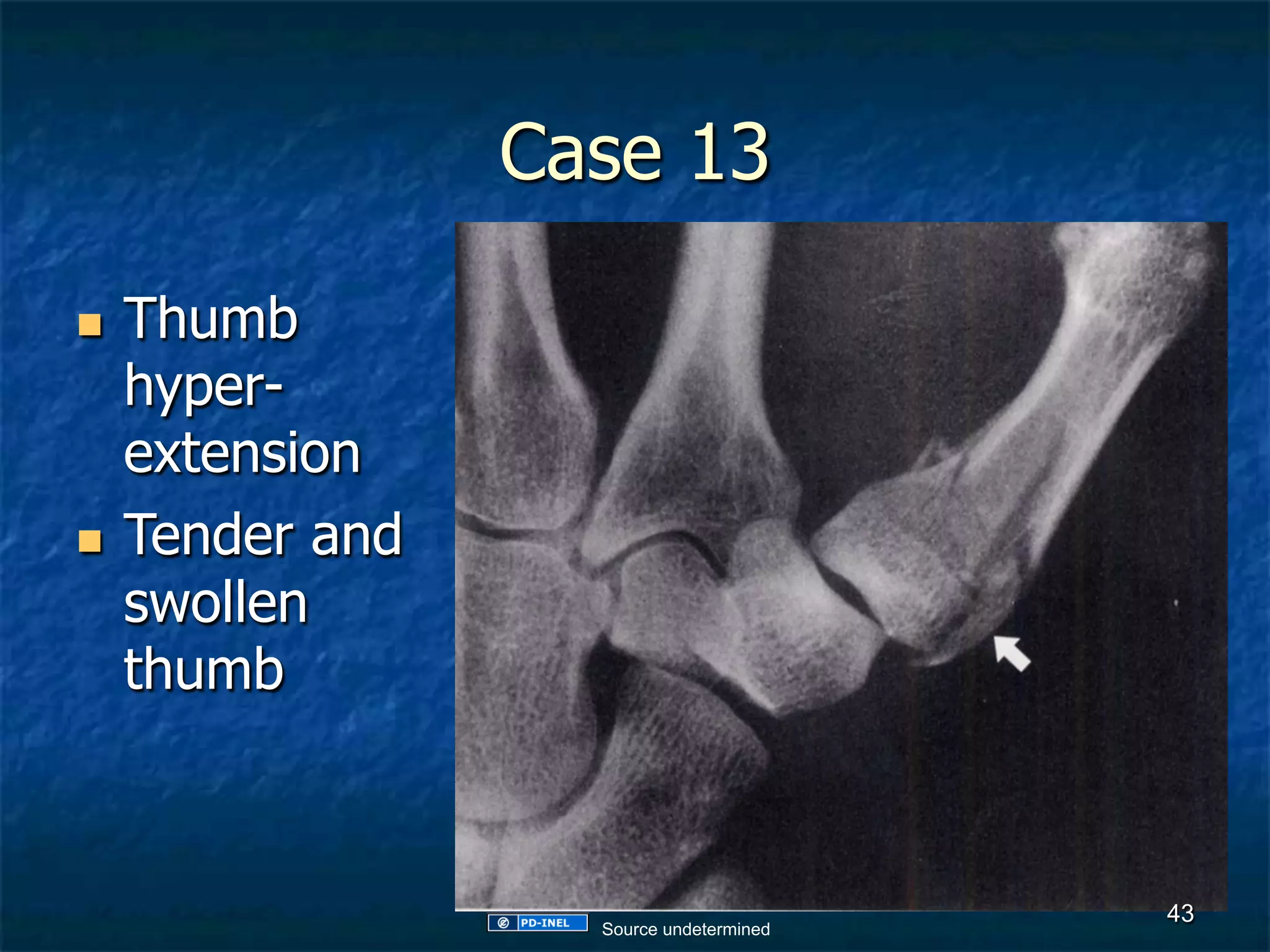 GEMC: Radiology: X-rays of the Hand and Wrist: Resident Training | PDF