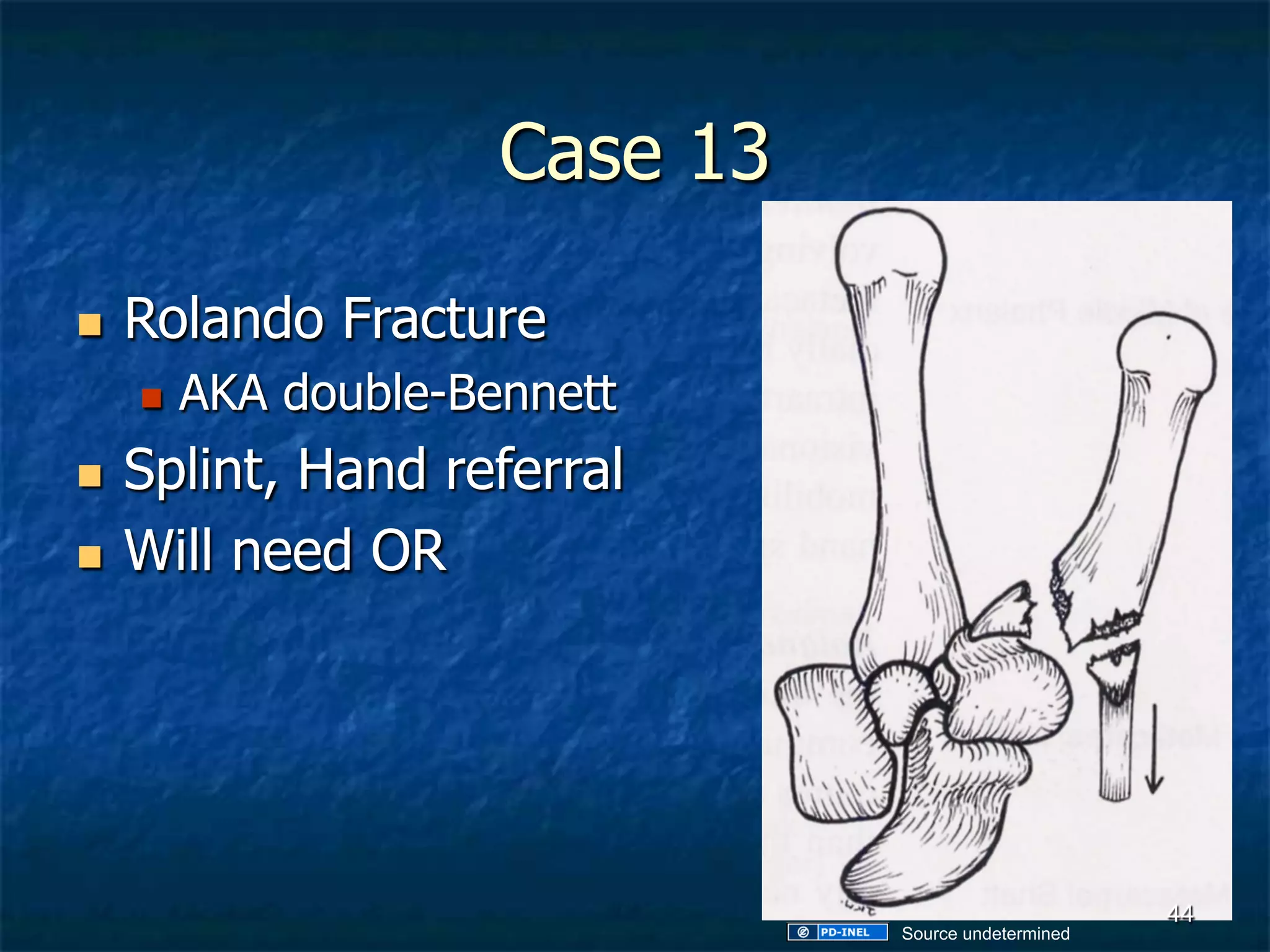 GEMC: Radiology: X-rays of the Hand and Wrist: Resident Training | PDF