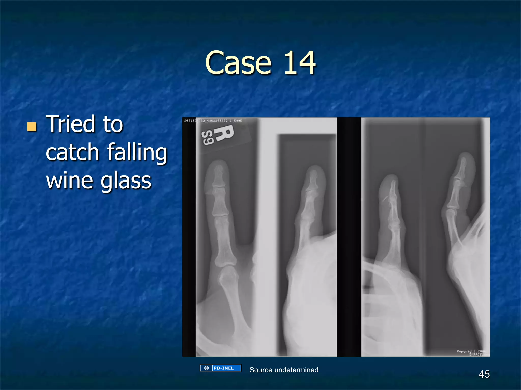 GEMC: Radiology: X-rays of the Hand and Wrist: Resident Training | PDF