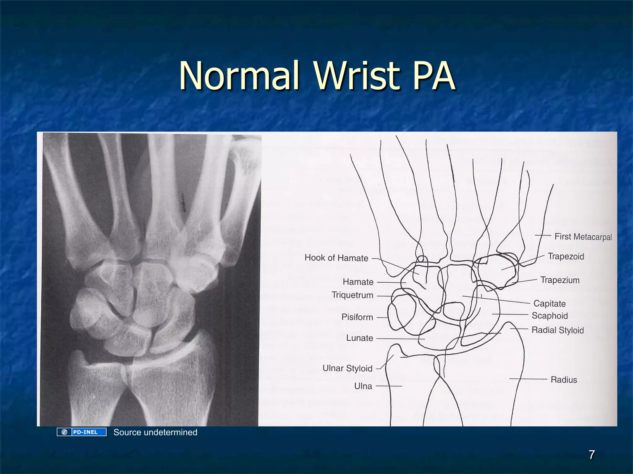 GEMC: Radiology: X-rays of the Hand and Wrist: Resident Training | PDF