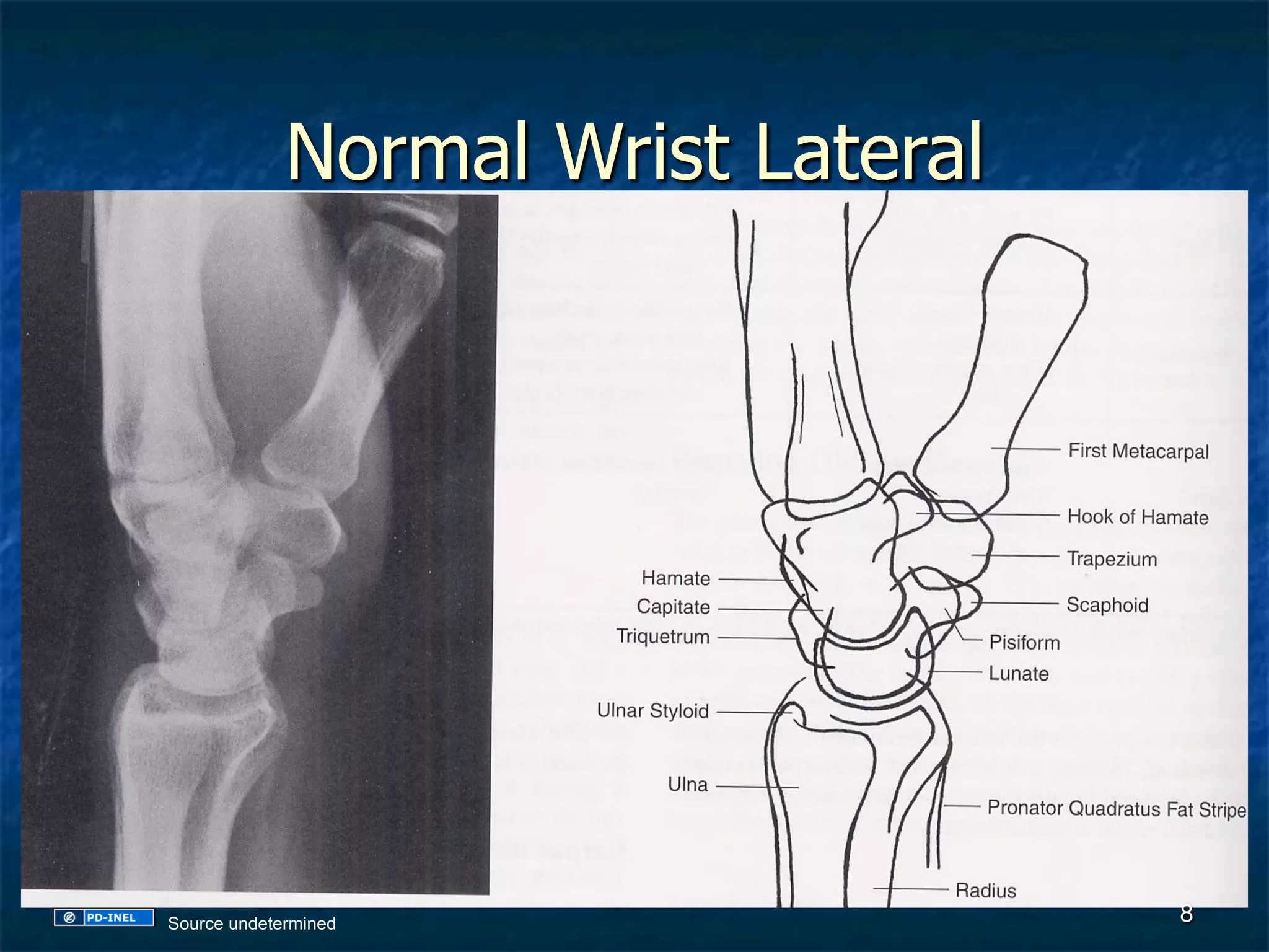 GEMC: Radiology: X-rays of the Hand and Wrist: Resident Training | PDF