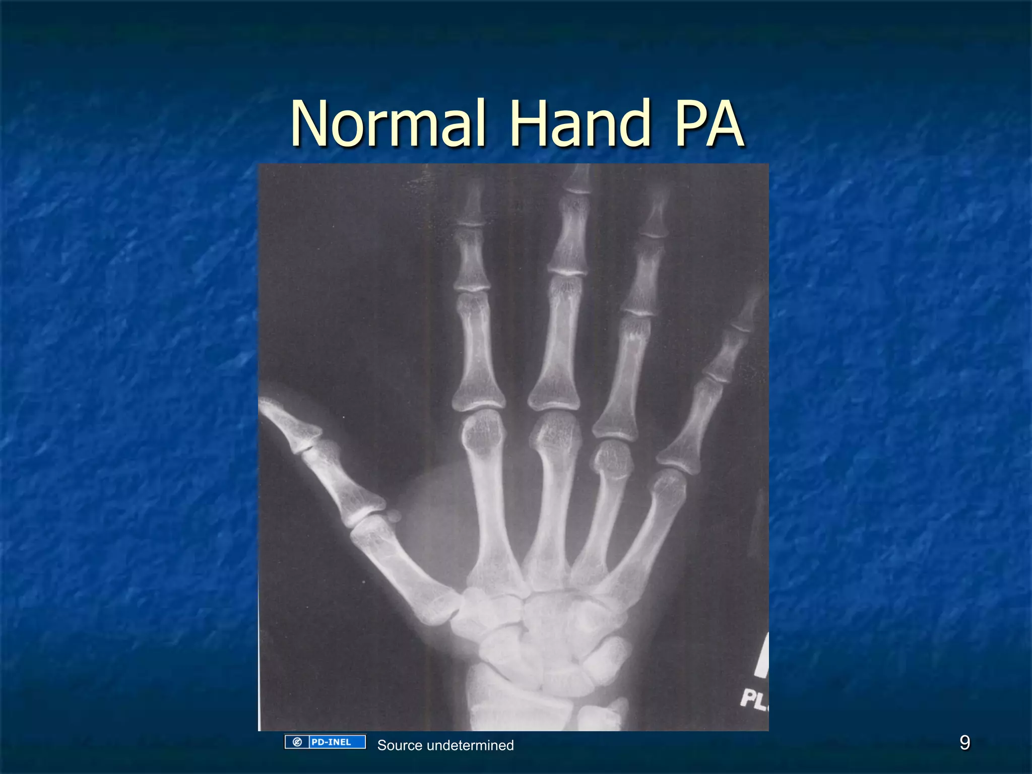 GEMC: Radiology: X-rays of the Hand and Wrist: Resident Training | PDF