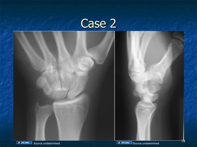 GEMC: Radiology: X-rays of the Hand and Wrist: Resident Training | PDF