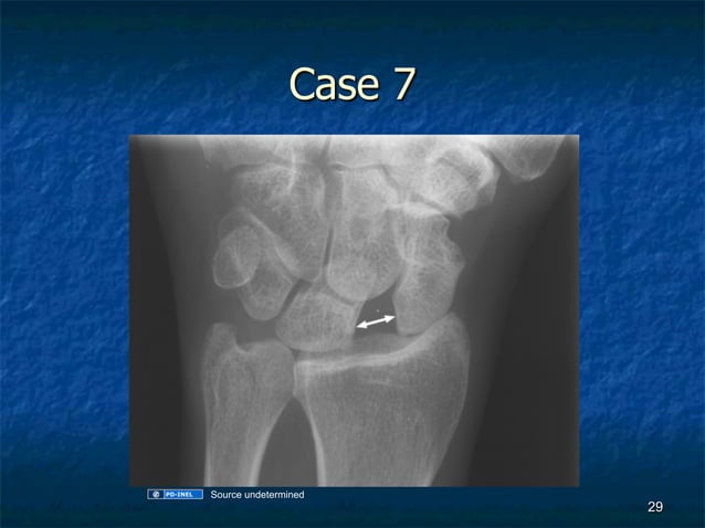 GEMC: Radiology: X-rays of the Hand and Wrist: Resident Training | PDF