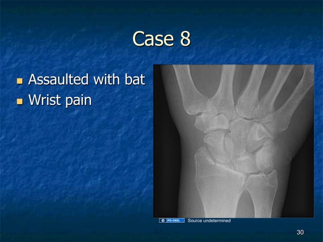 GEMC: Radiology: X-rays of the Hand and Wrist: Resident Training | PDF