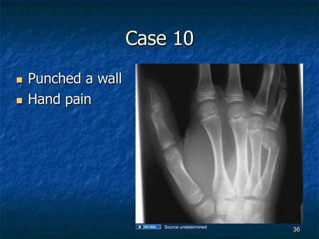 GEMC: Radiology: X-rays of the Hand and Wrist: Resident Training | PDF
