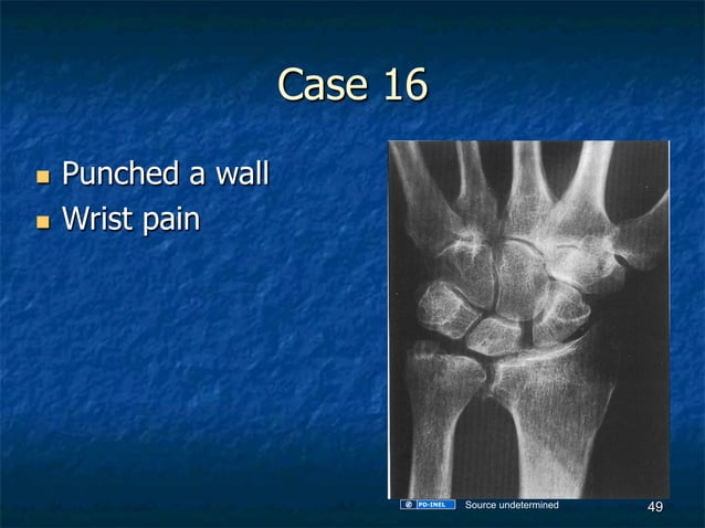 GEMC: Radiology: X-rays of the Hand and Wrist: Resident Training | PDF