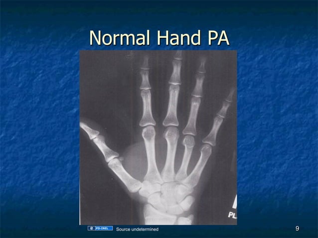 GEMC: Radiology: X-rays of the Hand and Wrist: Resident Training | PDF
