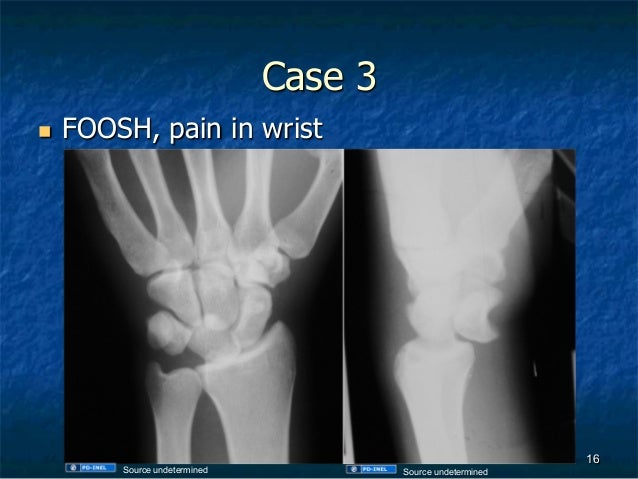 GEMC: Radiology: X-rays of the Hand and Wrist: Resident Training