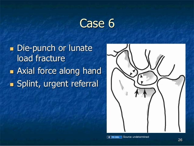 GEMC: Radiology: X-rays of the Hand and Wrist: Resident Training