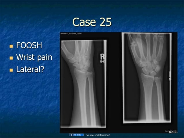 GEMC: Radiology: X-rays of the Hand and Wrist: Resident Training