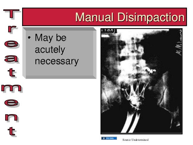 GEMC- The Adult Patient with Constipation- Resident Training