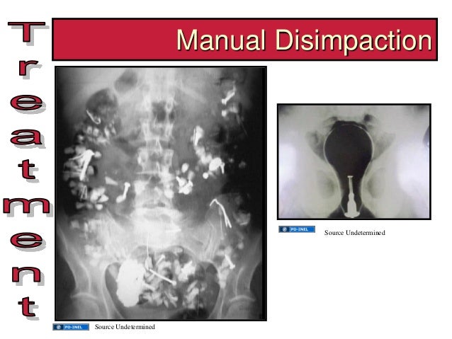 GEMC- The Adult Patient with Constipation- Resident Training