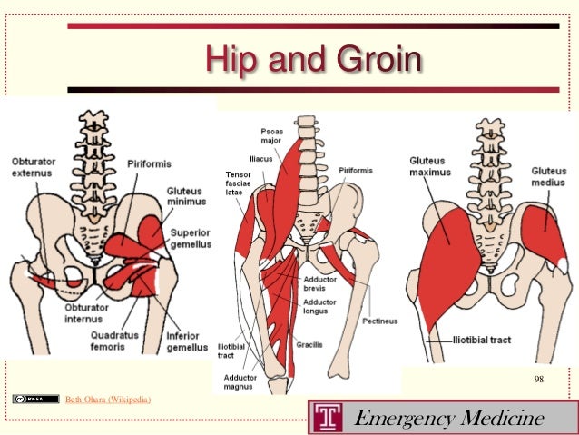 GEMC- Bursitis, Tendonitis, Fibromyalgia, and RSD- Resident Training