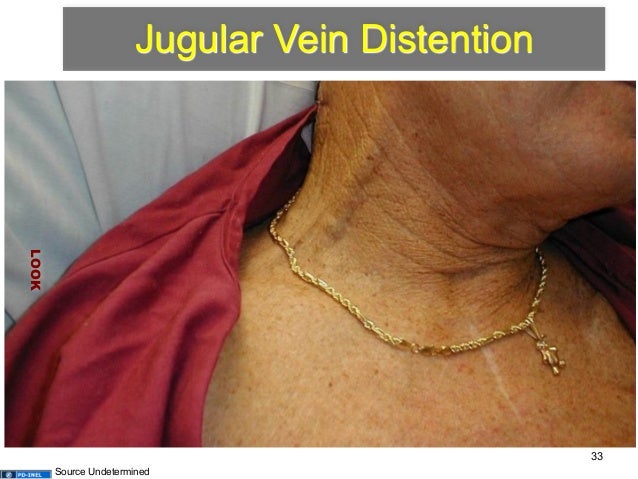 GEMC- Cardiac Evalutation- Resident Training