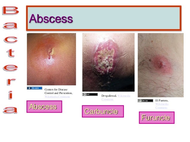 GEMC- Cutaneous Emergency- Resident Training