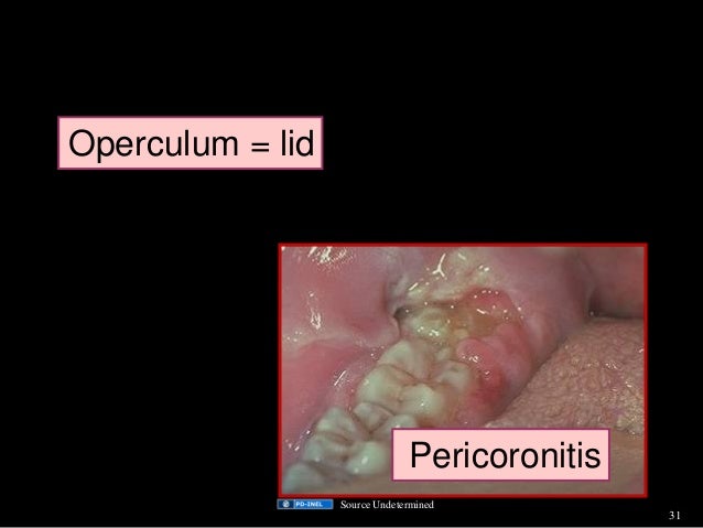 GEMC- Dental Emergencies and Common Dental Blocks- Resident Training