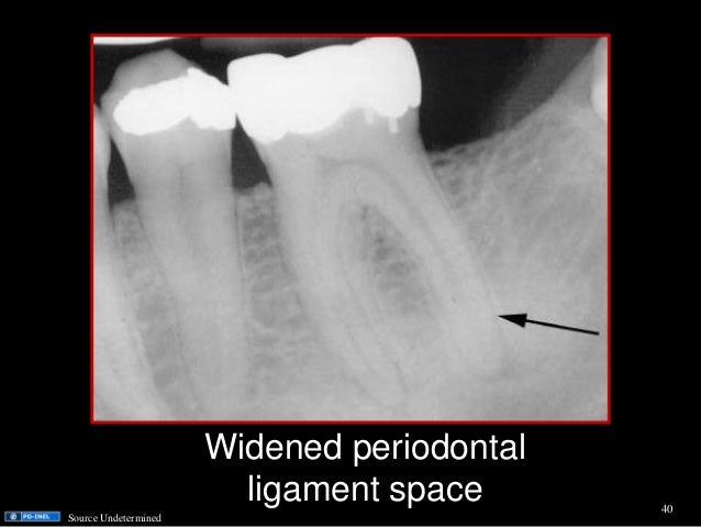 GEMC- Dental Emergencies and Common Dental Blocks- Resident Training