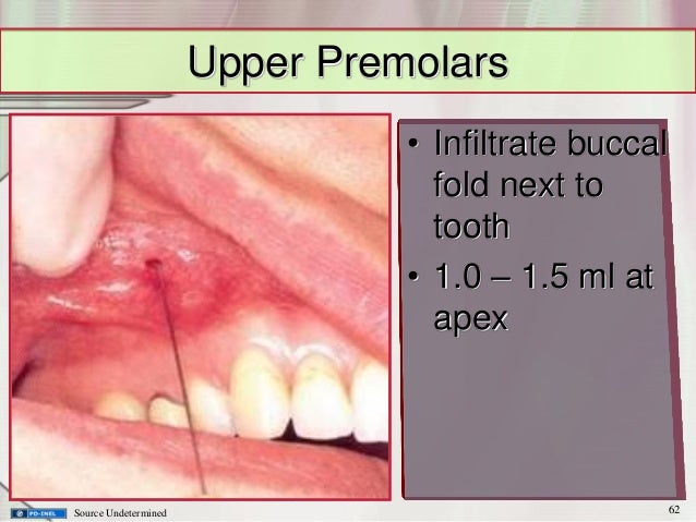 GEMC- Dental Emergencies and Common Dental Blocks- Resident Training
