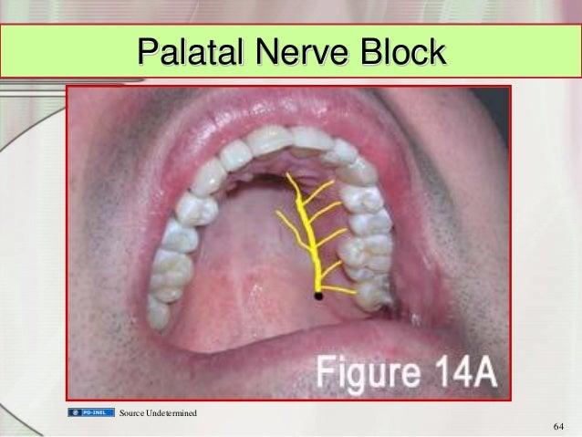 GEMC- Dental Emergencies and Common Dental Blocks- Resident Training