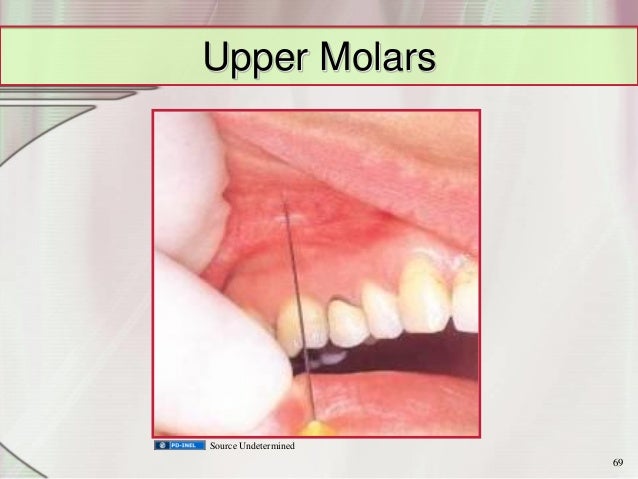 GEMC- Dental Emergencies and Common Dental Blocks- Resident Training