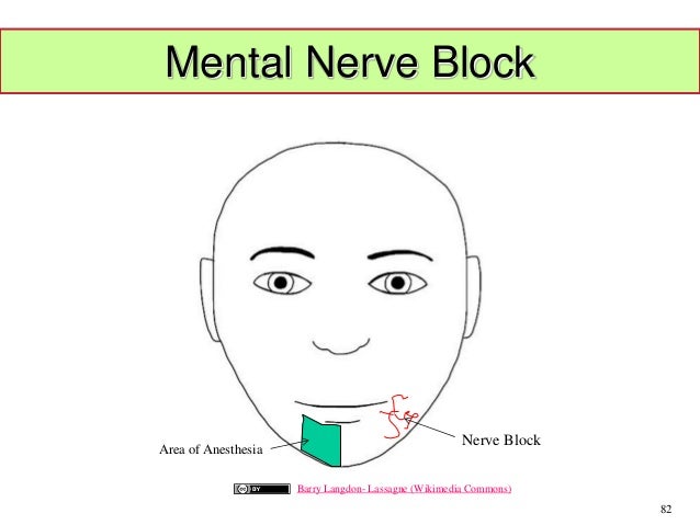 GEMC- Dental Emergencies and Common Dental Blocks- Resident Training