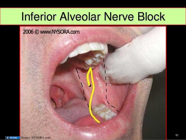 Gemc Dental Emergencies And Common Dental Blocks Resident Training