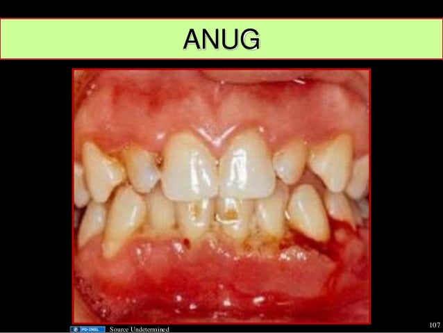 GEMC- Dental Emergencies and Common Dental Blocks- Resident Training