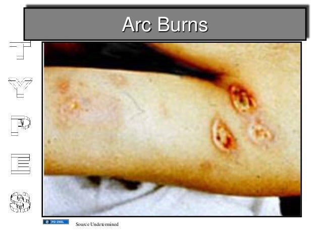 GEMC- Electrical Misadventures- Resident Training