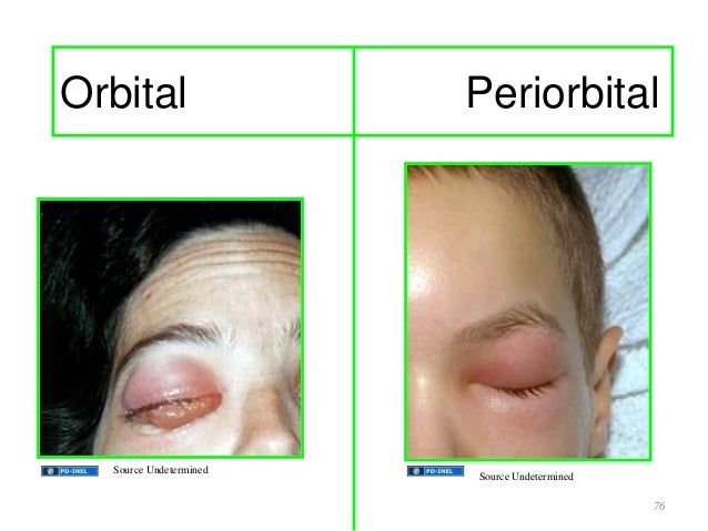 GEMC- Ocular Emgercencies- Resident Training