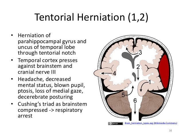GEMC- Pediatric Neurologic Emergencies- Resident Training