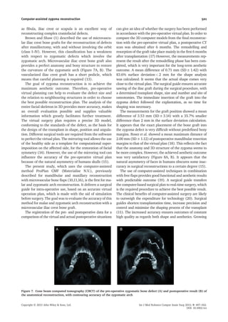 2013 modabber-zygoma-reconstruction | PDF