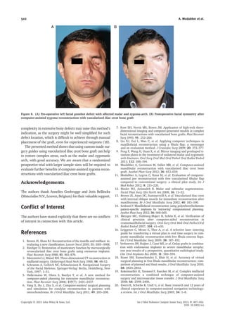2013 modabber-zygoma-reconstruction | PDF