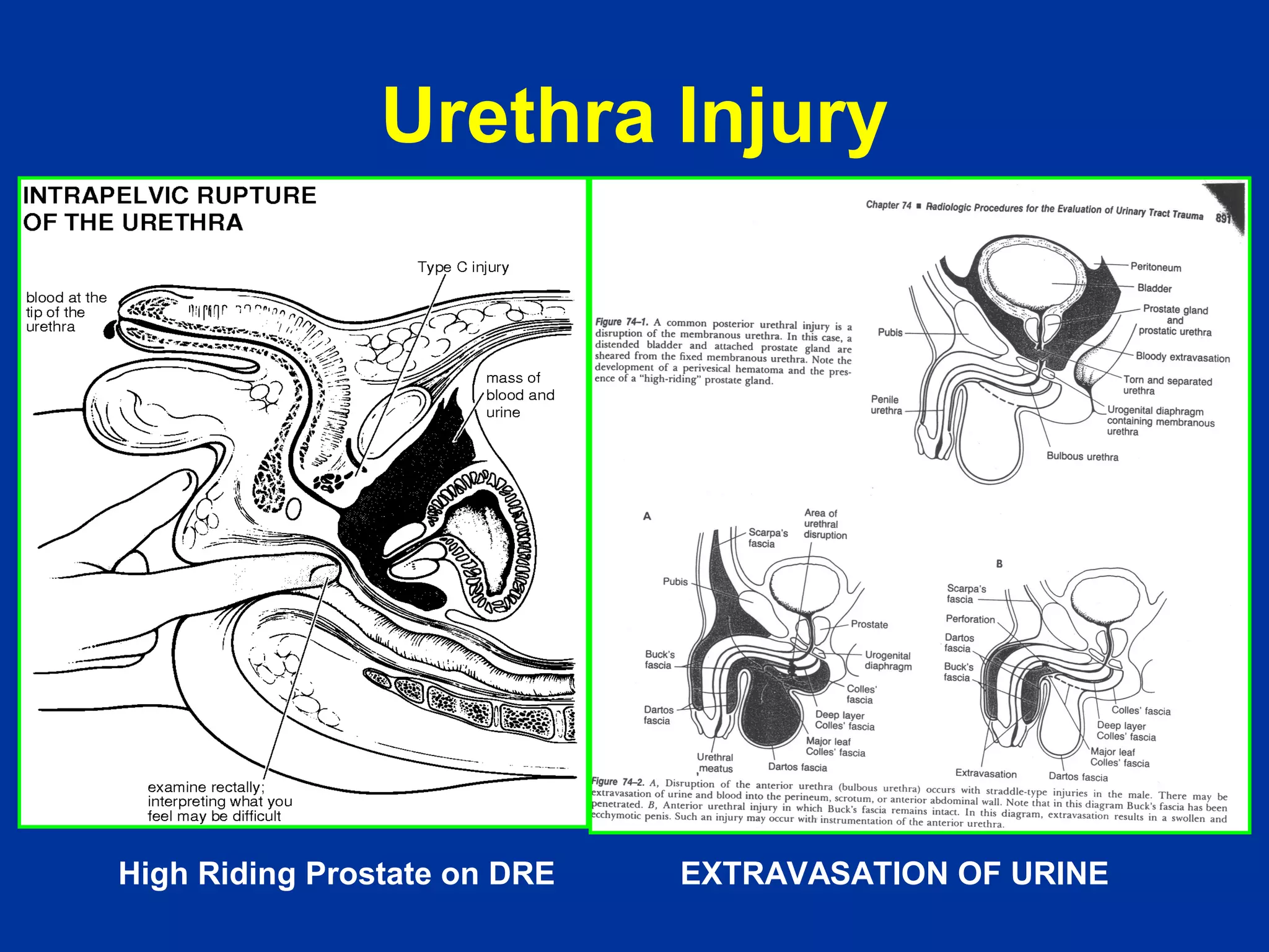 urethrography | PPT