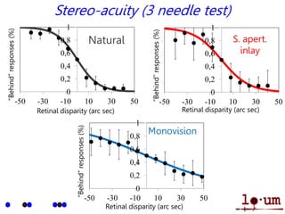 Monovision vs Pinhole | PDF