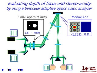 Monovision vs Pinhole | PDF