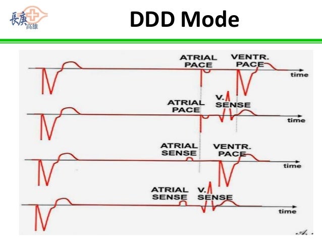 心臟植入性電子儀器(CIED)的基本原理及設定